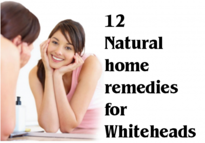 Top 12 Natural Home remedies for Whiteheads - theorangepetals